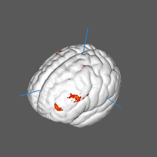 teaching:writing_assignment_part_2 [Visual Cognitive Neuroscience]